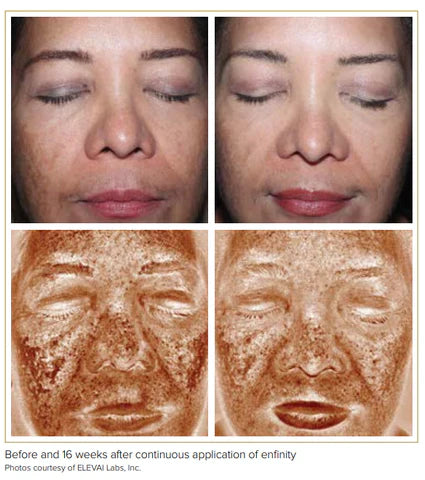 ELEVAI enfinity™ Daily Exosome Serum 30mL – beautynookdev